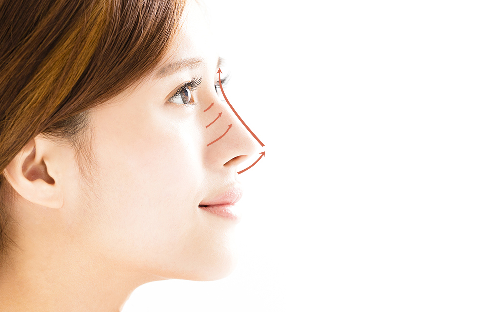 3D Nose Lift: All You Need to Know - SKIN Magazine