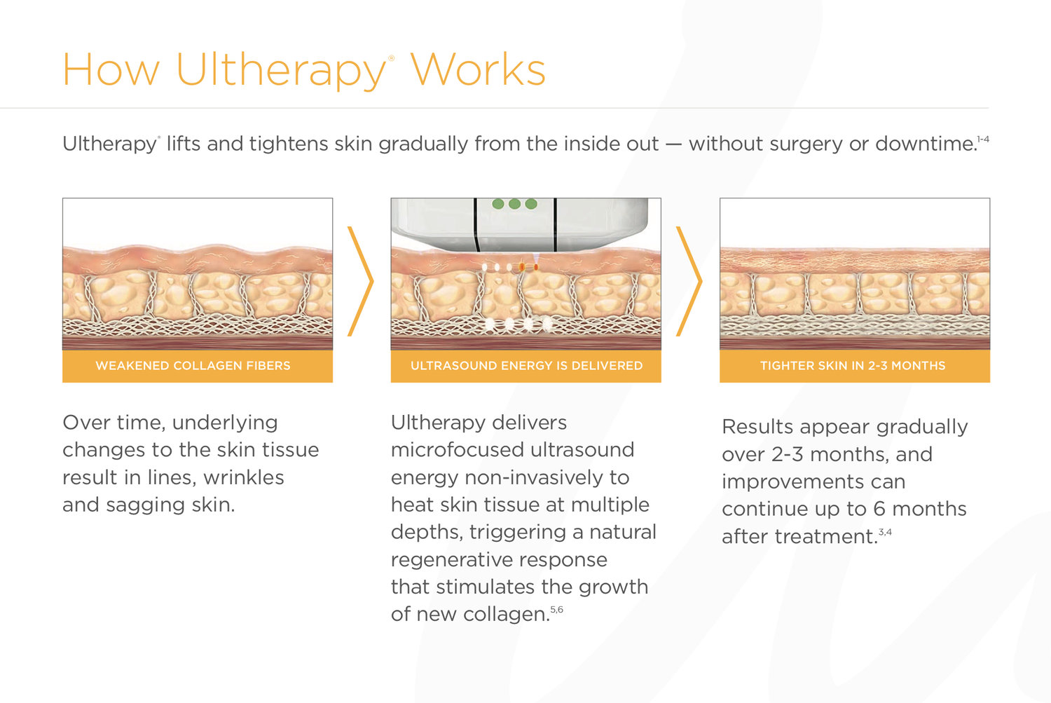 Ultherapy: A Non-Surgical Facelift - SKIN Magazine